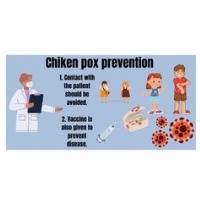 Chicken pox , symptoms and prevention - educationallof